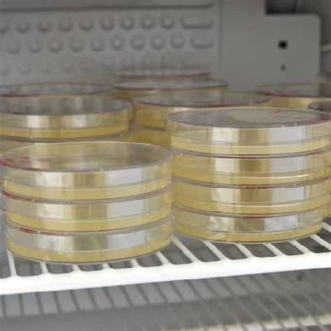 Agar Plates The Ultimate Guide For Mycology Enthusiasts Artisan Vaping