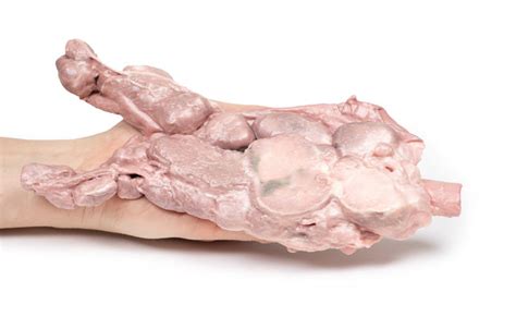 Aorta And Para Aortic Lymph Nodes 3d Replica