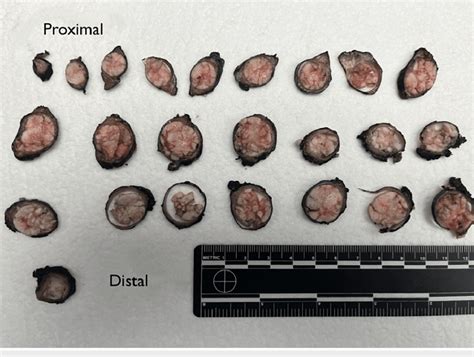 Cross Sections Of The Right Ureter Obtained From The Patient Arranged Download Scientific