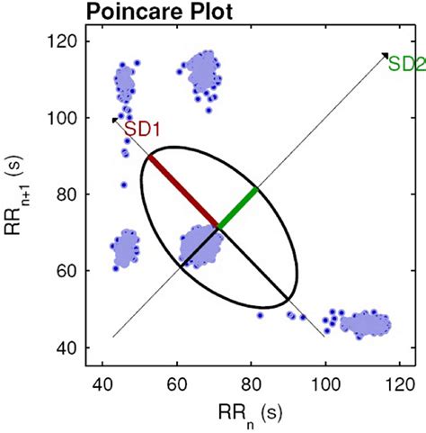 poincare plot for abnormal rhythm 119 mat b comparison download