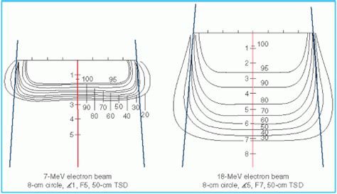 Electron Beam Therapy Radiology Key