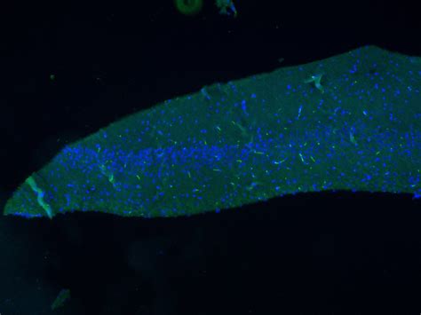 Pax6 Antibody 84345 5 Pbs Proteintech