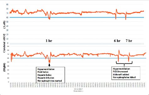 Regional Cerebral Oxygen Saturation Records By Near Infrared Download Scientific Diagram