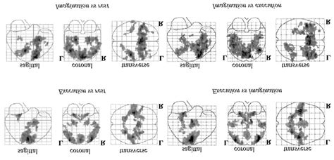 Statistical Parametric Maps Spms Of The Group Analysis Random