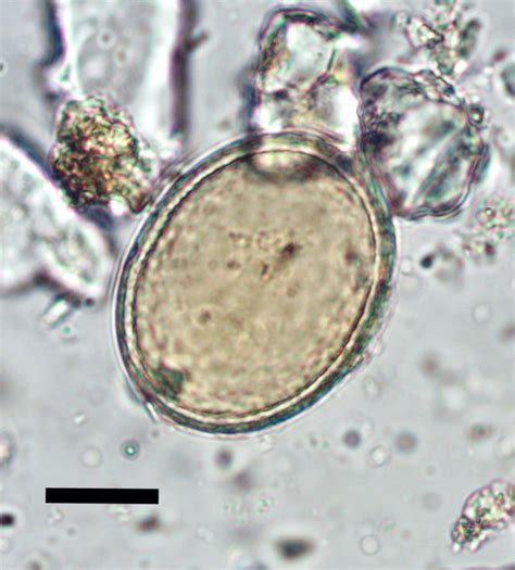 Roundworm Under Microscope