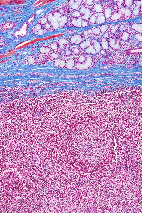 Tonsil Light Micrograph Stock Image C0543897 Science Photo Library