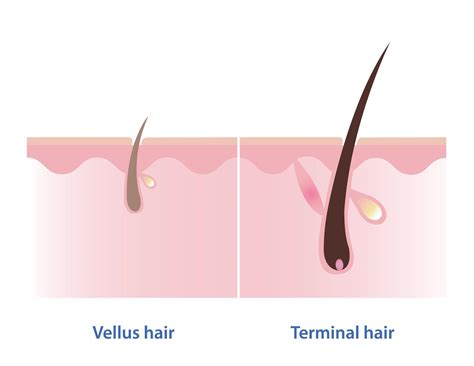 What Is Vellus Hair Expert Guide Pjlm