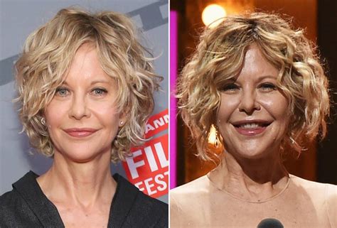 Meg Ryan Before And After Plastic Surgery Vrogue Co