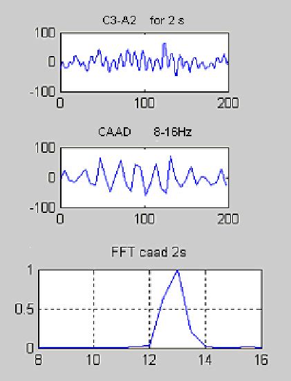 2 S Sleep Eeg Data With 8 16hz Wavelet Transform Analysis Download Scientific Diagram