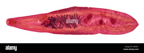 Opisthorchis Sinensis