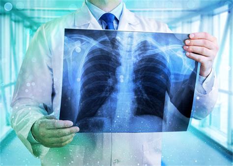 Doxycyclinum Polfarmex Opinie Wskazania Działanie Dawkowanie