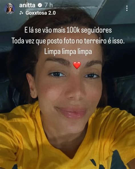 Anitta Publicou Algumas Fotos Com Cliques Lindos Na Data De Ontem
