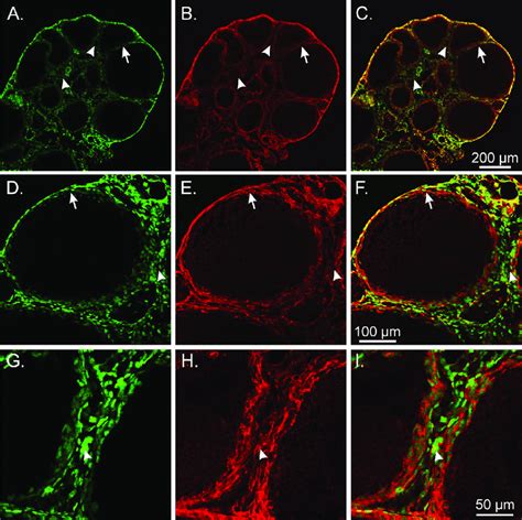 Double Labeling Of Egfp Pdgfra þ Nuclei And Pdgfra Antibody In The Download Scientific Diagram