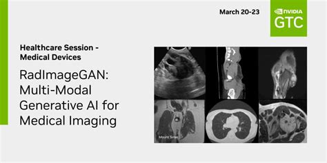 Mehrzad Samadi On Linkedin Radimagegan Multi Modal Generative Ai For Medical Imaging