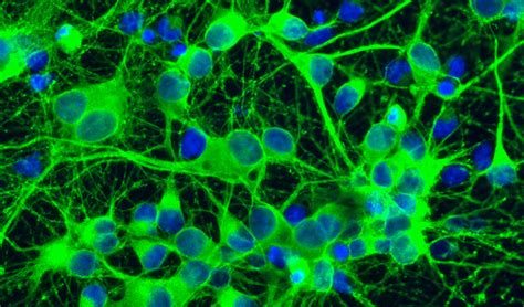 Neurons Astrocytes Microglia High Quality Primary Cells Source Tebubio