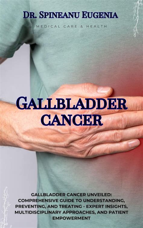 Gallbladder Cancer Unveiled Comprehensive Guide To Understanding Preventing And Treating