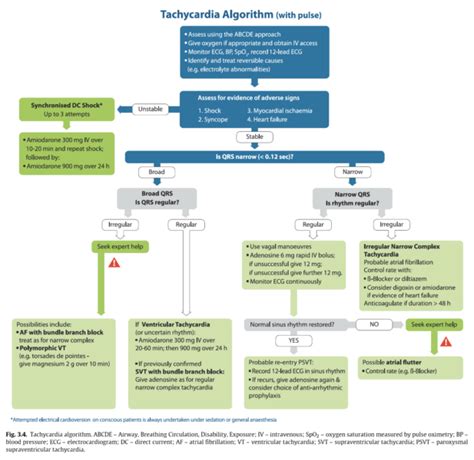 Tachycardie E Cardiogram Tachycardie E Cardiogram