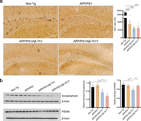 Aβ Th1 and Aβ Th17 cells affect neurogenesis and synaptic plasticity in Download Scientific