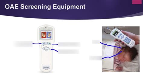 Csd 437 Oae Screening Equipment Labeling Diagram Quizlet
