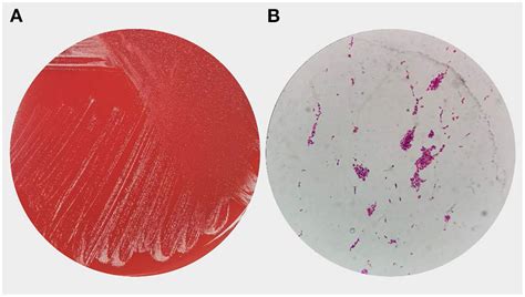 Overview Of Abiotrophia Defectiva Of Growth Morphology A Colony Download Scientific Diagram