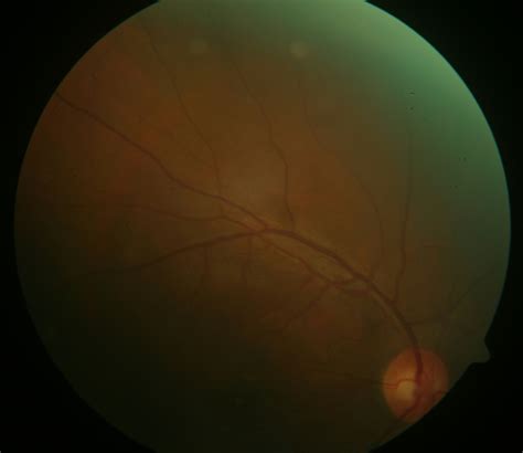 Github Kavitha Gretinal Image Quality Assessment Analyse Adequacy