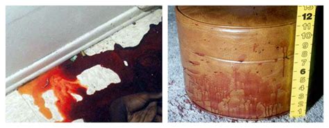 Bloodstain Pattern Analysis How Its Done