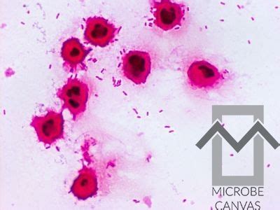 Proteus Morganii Gram Stain