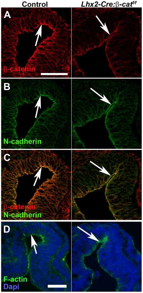 B Catenin Remains Associated With N Cadherin And Factin At The Apical
