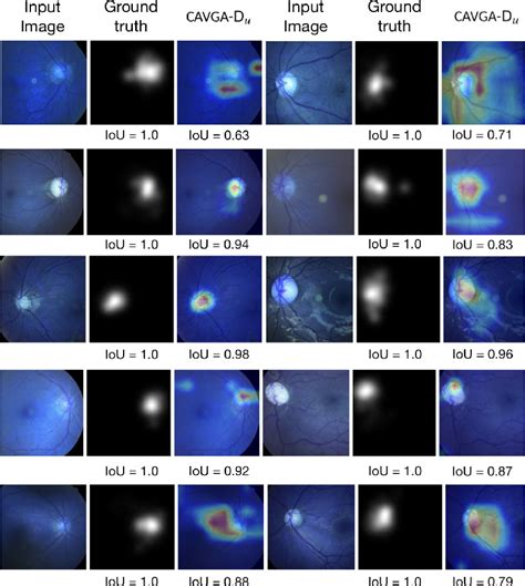 Figure 1 From Attention Guided Anomaly Localization In Images Supplementary Material Semantic