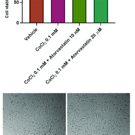 Effect Of A Cocl2 0 1 Mm Cocl2 0 1 Mm Atorvastatin 10 Nm And