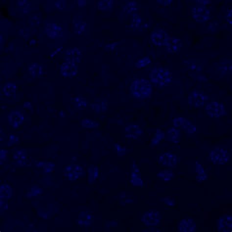 3d Image Preprocessing And Nuclear Segmentation Image Analysis Image Sc Forum