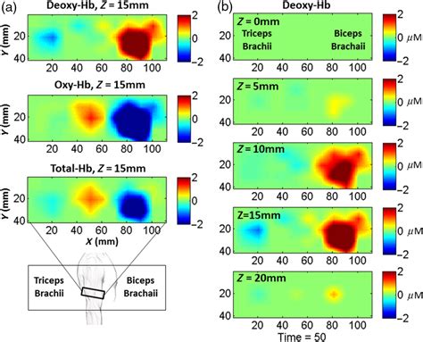 Ambulatory Diffuse Optical Tomography And Multimodality Physiological Monitoring System For