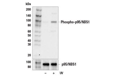 Mrn Complex Antibody Sampler Kit Cell Signaling Technology