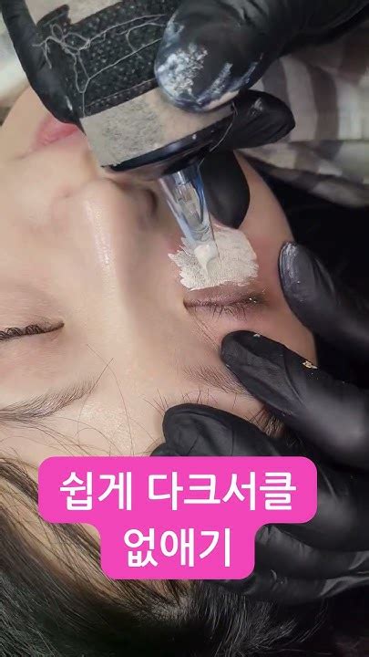 다크서클 쉽게 지우자 다크서클 다크서클제거 다크서클커버 다크서클타투 기미 기미제거 기미타투 두피 두피관리 흉터