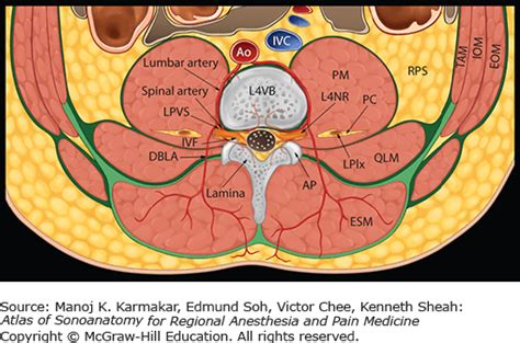 Sonoanatomy Relevant For Ultrasound Guided Lumbar Plexus Block Anesthesia Key