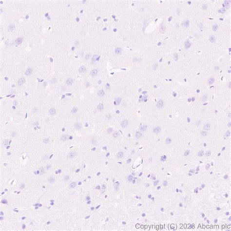 Anti Streptococcus Mutans Cell Surface Antigen I Ii Antibody [epr28235 11] Ab316006 Abcam