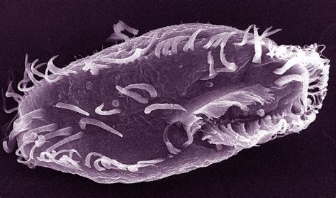 Oxytricha Scielo Brasil Ciliate Protists From Cabiúnas Lagoon