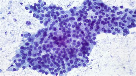 Biological Security Weekly Update March 2022 Biological Security