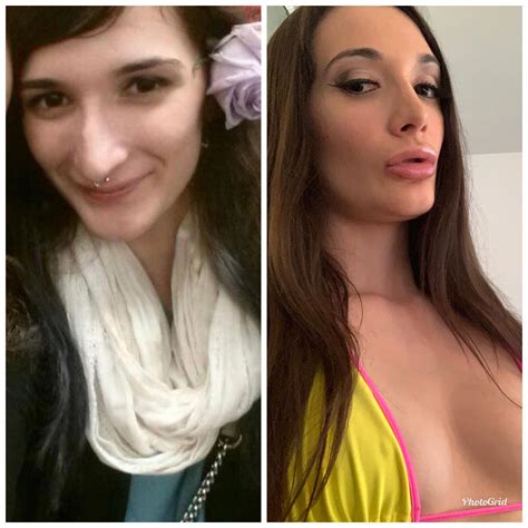 First Time Poster My Progress Over The Years Ive Had A Nose Job