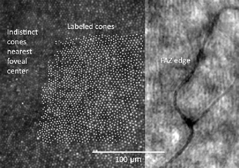 Left Master Cone Image Approximately 058 To 108 From Foveal Center