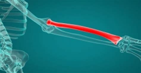 What Is The Radius Facty Health