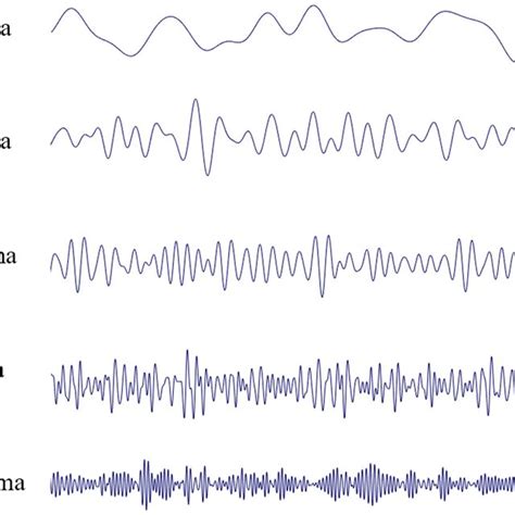 Eeg Recordings Performed In Patients The Waveform Can Be Download