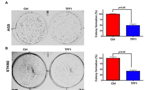 Reconstitution Of Tff1 Expression Suppresses Cell Growth In Vitro