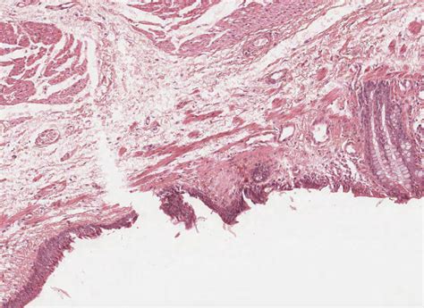 Rectoanal Junction Histology