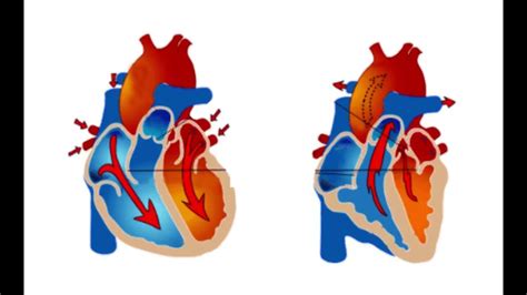 გულის მუშაობა Youtube