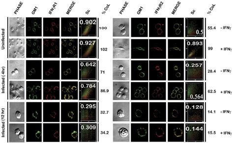 Confocal Colocalization Analysis Of The Ifn C R Subunits In Uninfected