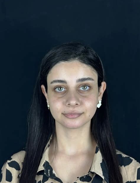 Anti Aging Youthful Look Reveal Younger Fresher Skin Bmc