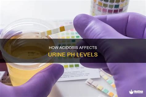 How Acidosis Affects Urine Ph Levels Medshun
