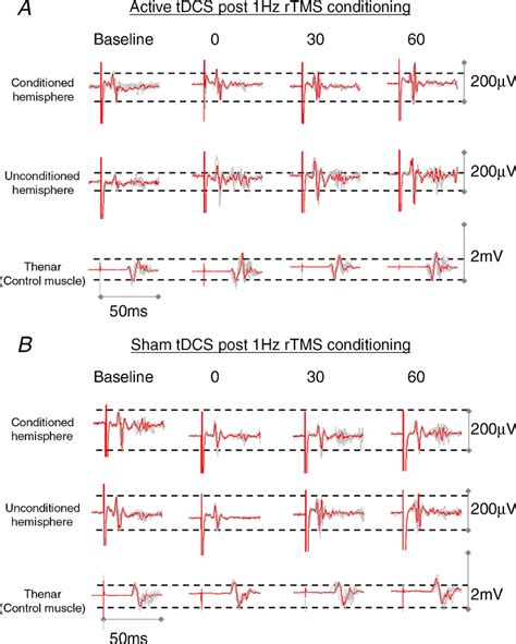 Representative Pmep And Tmep Data Traces From An Individual Participant