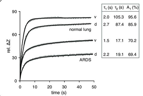 Representative Regional Electrical Impedance Tomography Eit Waveforms Download Scientific
